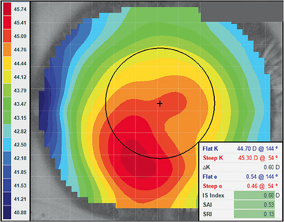 Contact Lens Spectrum | PentaVision