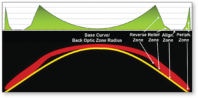 Contact Lens Spectrum | PentaVision