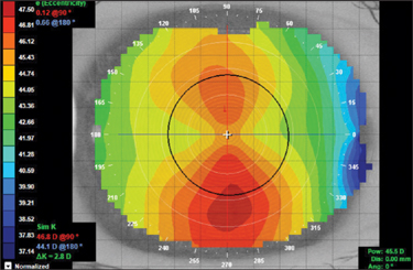 Contact Lens Spectrum | PentaVision