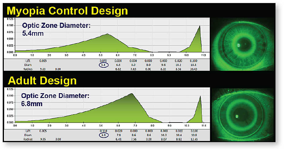 Contact Lens Spectrum | PentaVision