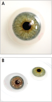 Contact Lens Spectrum | PentaVision