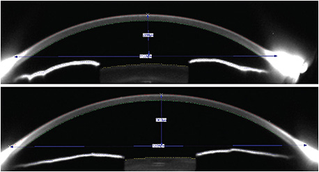 Contact Lens Spectrum | PentaVision