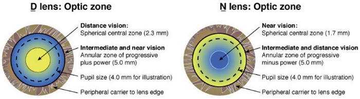 Contact Lens Spectrum | PentaVision