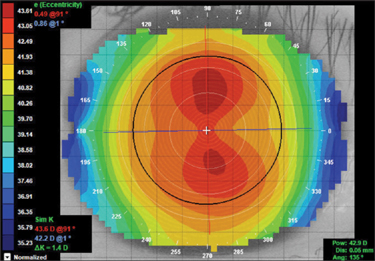 Contact Lens Spectrum | PentaVision