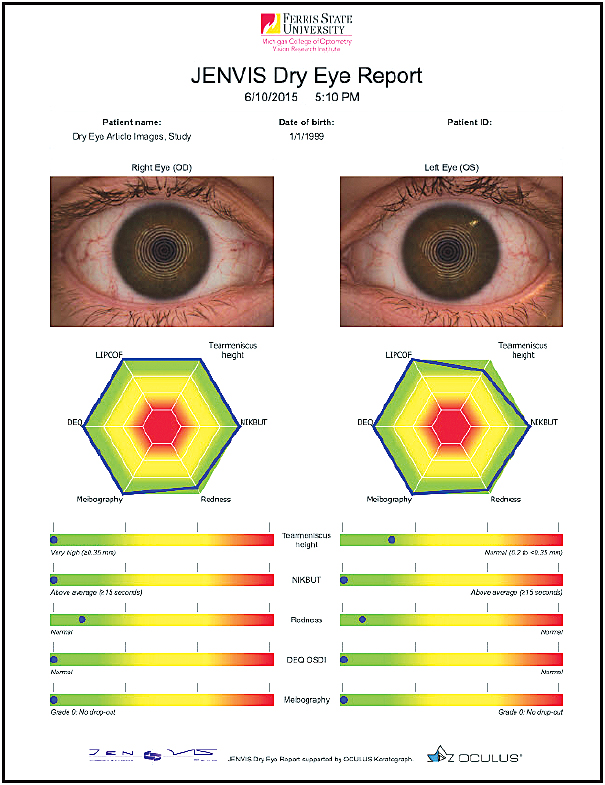 Contact Lens Spectrum | PentaVision