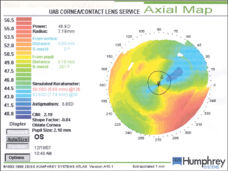 Contact Lens Spectrum | PentaVision