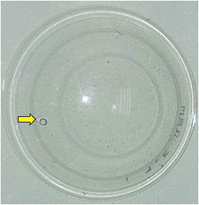 Contact Lens Spectrum | PentaVision