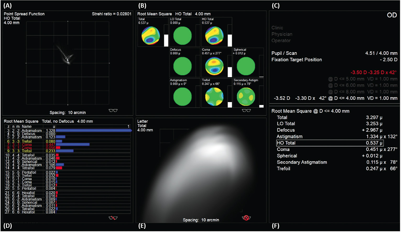Contact Lens Spectrum | PentaVision