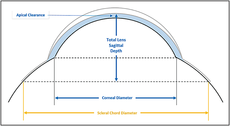 Contact Lens Spectrum | PentaVision