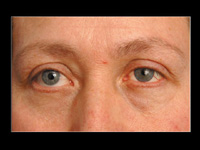 Contact Lens Spectrum | PentaVision