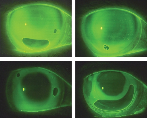 Contact Lens Spectrum | PentaVision