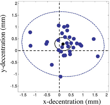 Contact Lens Spectrum | PentaVision