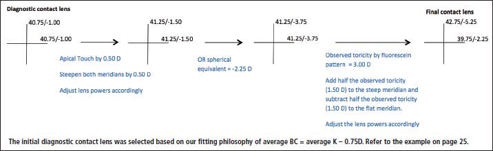Contact Lens Spectrum | PentaVision