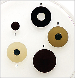Contact Lens Spectrum | PentaVision
