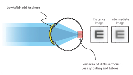 Contact Lens Spectrum | PentaVision