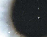 Contact Lens Spectrum | PentaVision