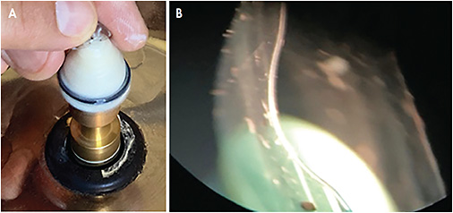 Contact Lens Spectrum | PentaVision