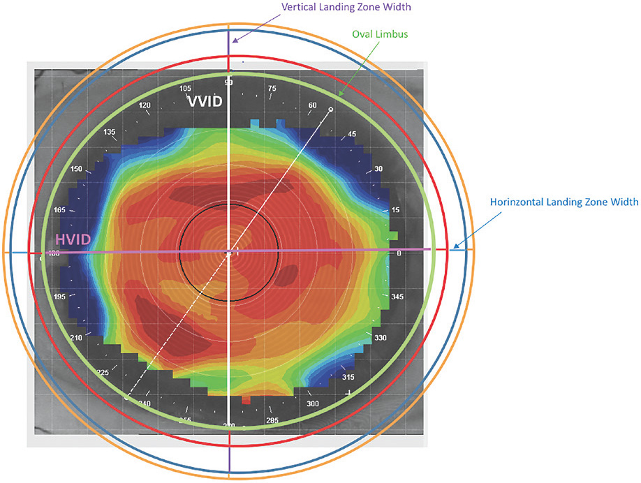 Contact Lens Spectrum | PentaVision