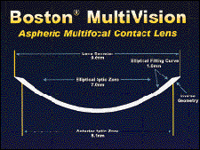 Contact Lens Spectrum | PentaVision