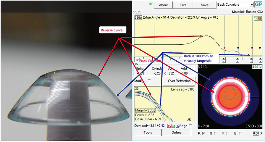 Contact Lens Spectrum | PentaVision