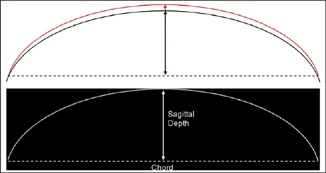 Contact Lens Spectrum | PentaVision