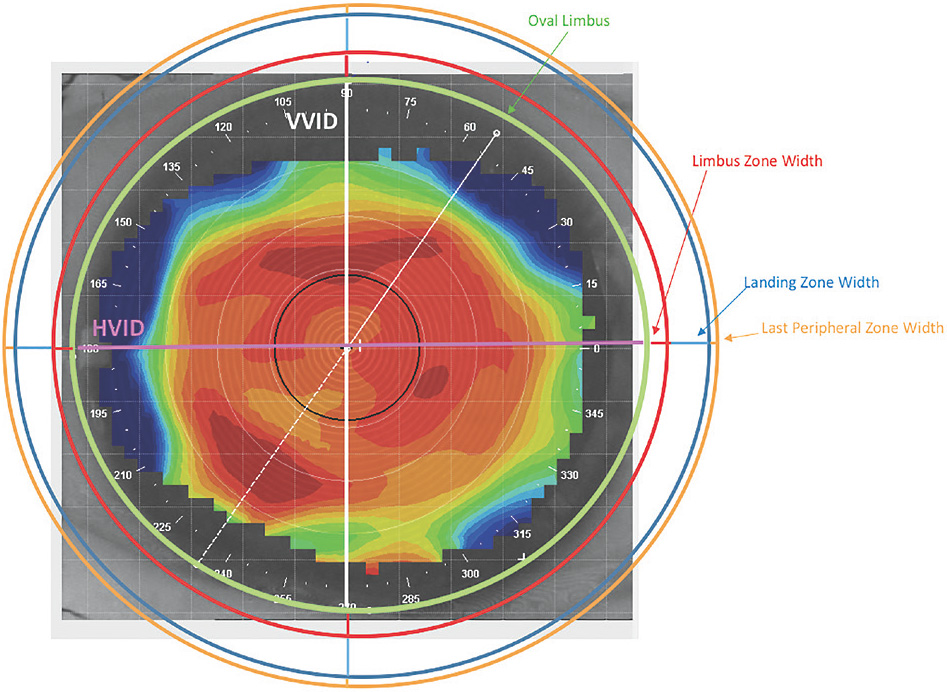Contact Lens Spectrum | PentaVision