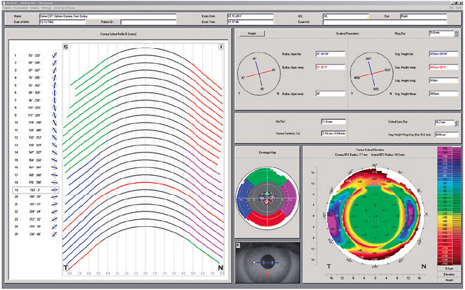 Contact Lens Spectrum | PentaVision