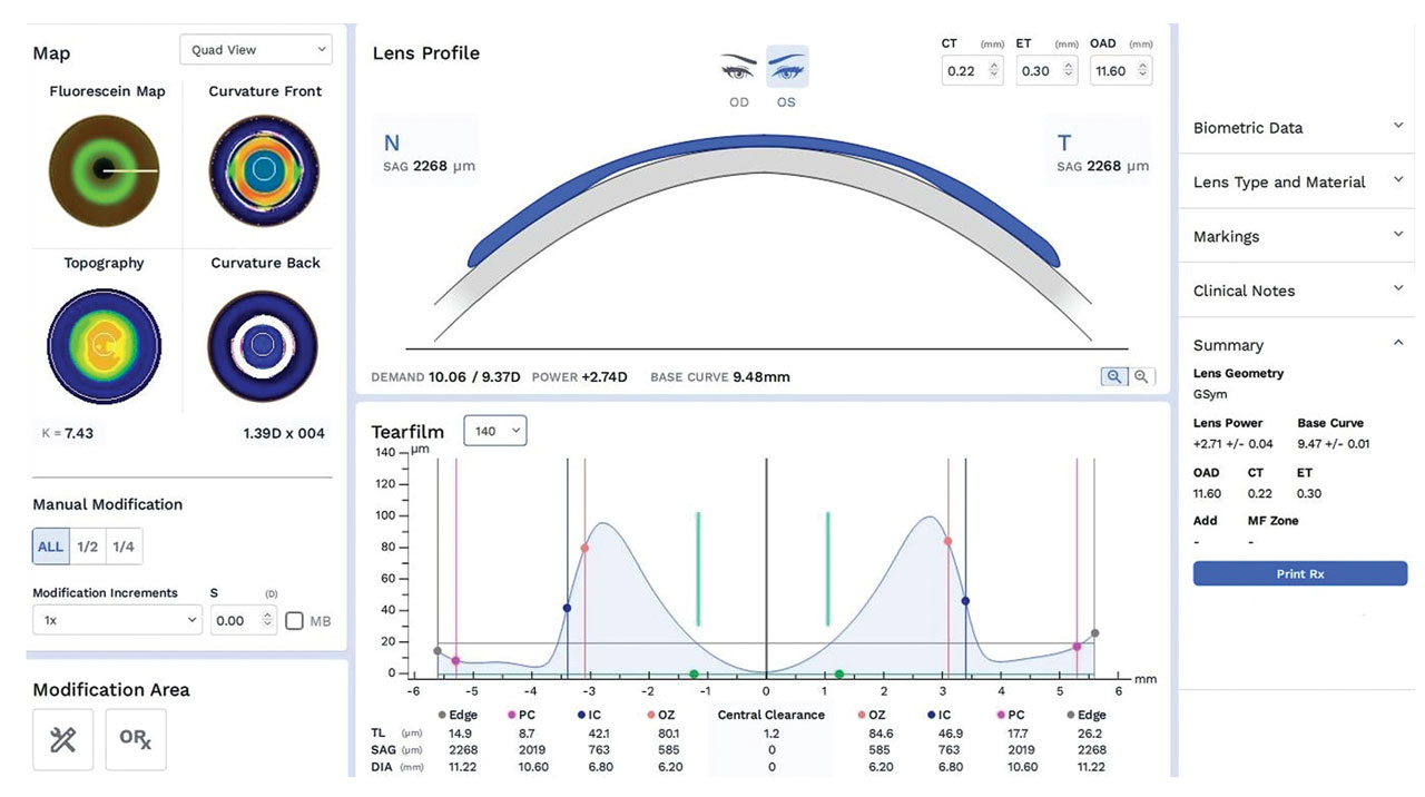 ORTHOKERATOLOGY TODAY | Contact Lens Spectrum