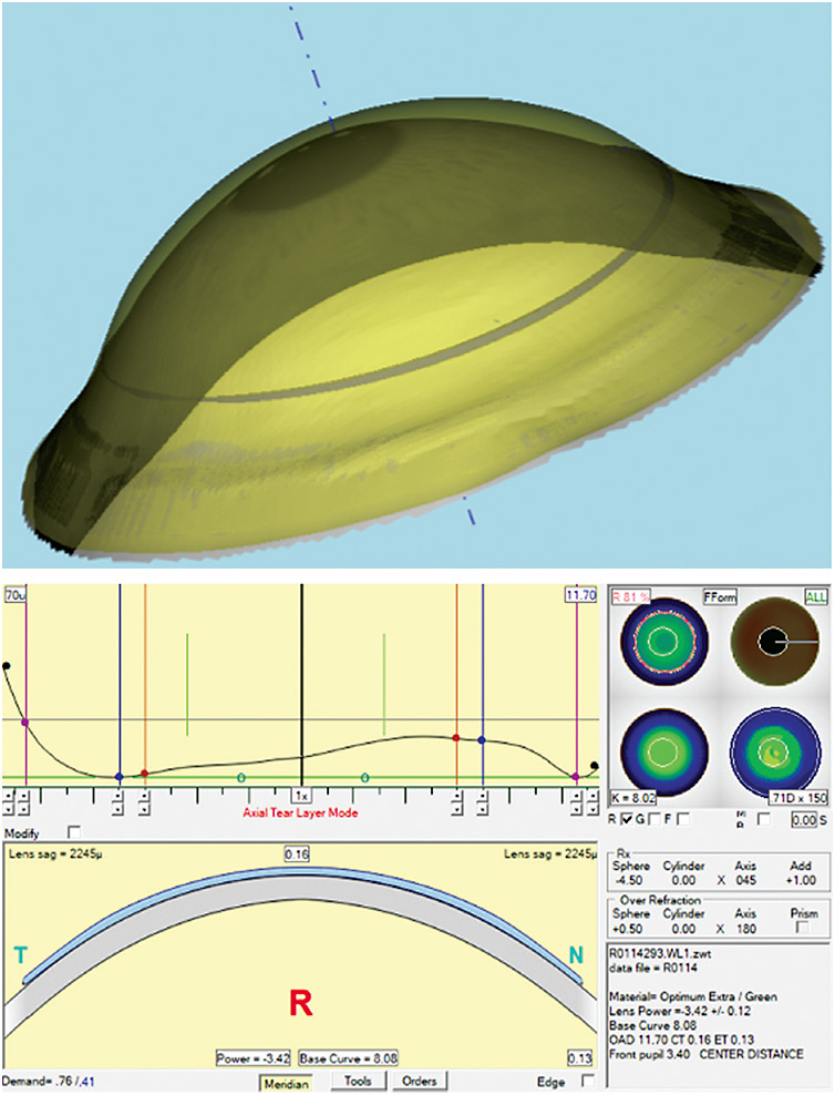 Contact Lens Spectrum | PentaVision