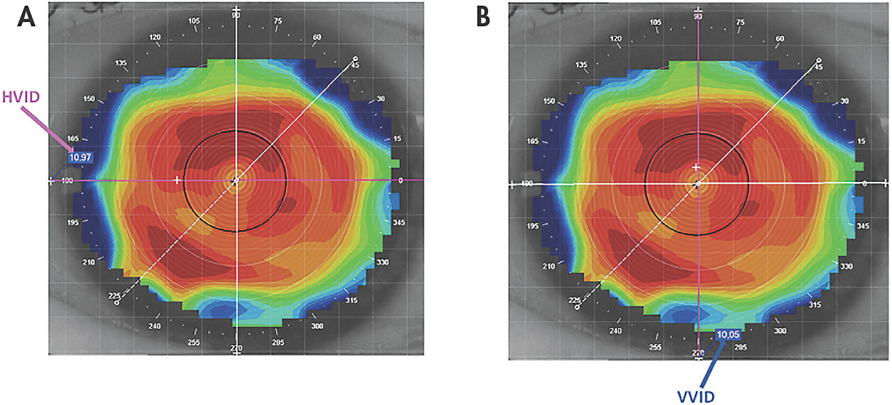 Contact Lens Spectrum | PentaVision