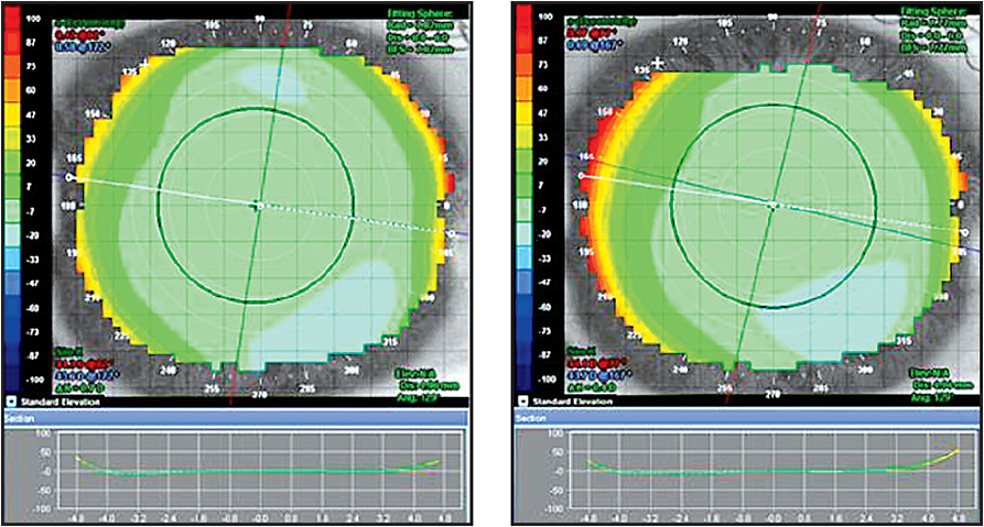 Contact Lens Spectrum | PentaVision