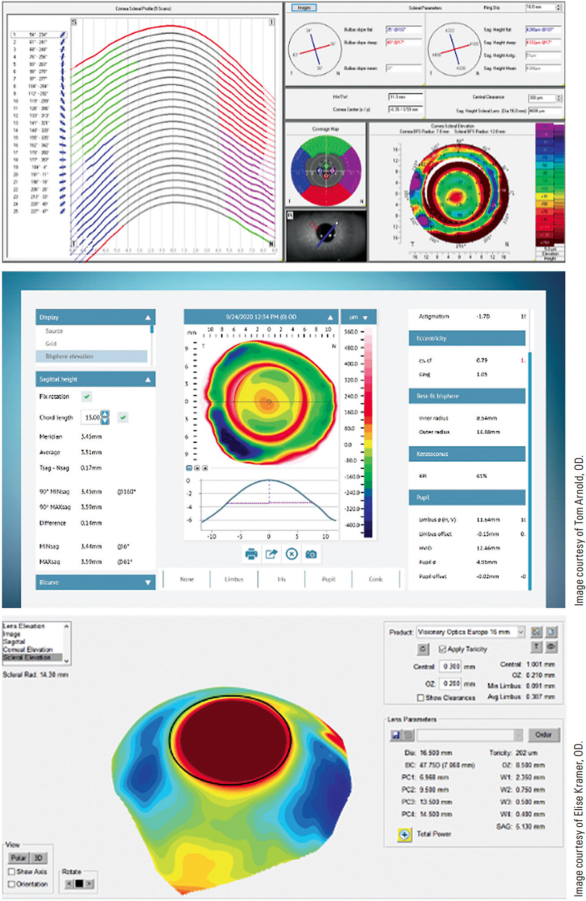 Contact Lens Spectrum | PentaVision