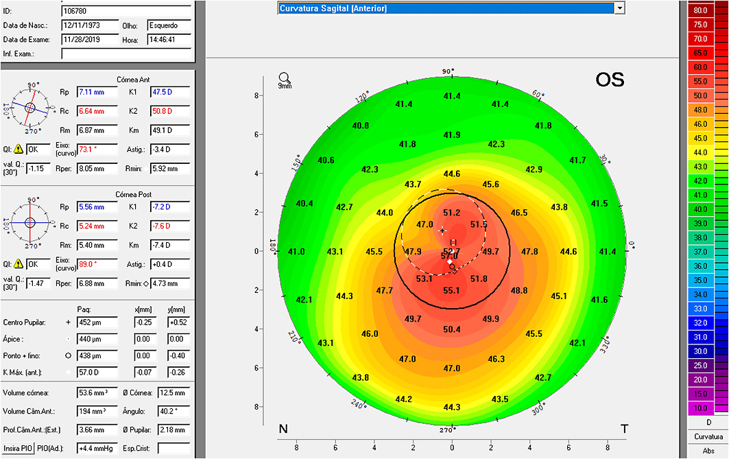 Contact Lens Spectrum | PentaVision