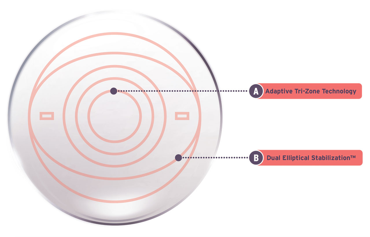 PRODUCT FOCUS | Contact Lens Spectrum