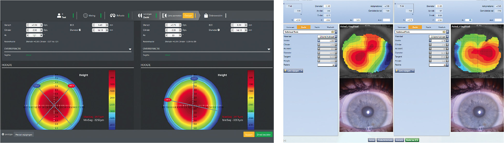 Contact Lens Spectrum | PentaVision