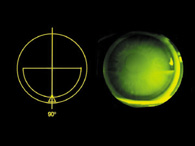 Contact Lens Spectrum | PentaVision